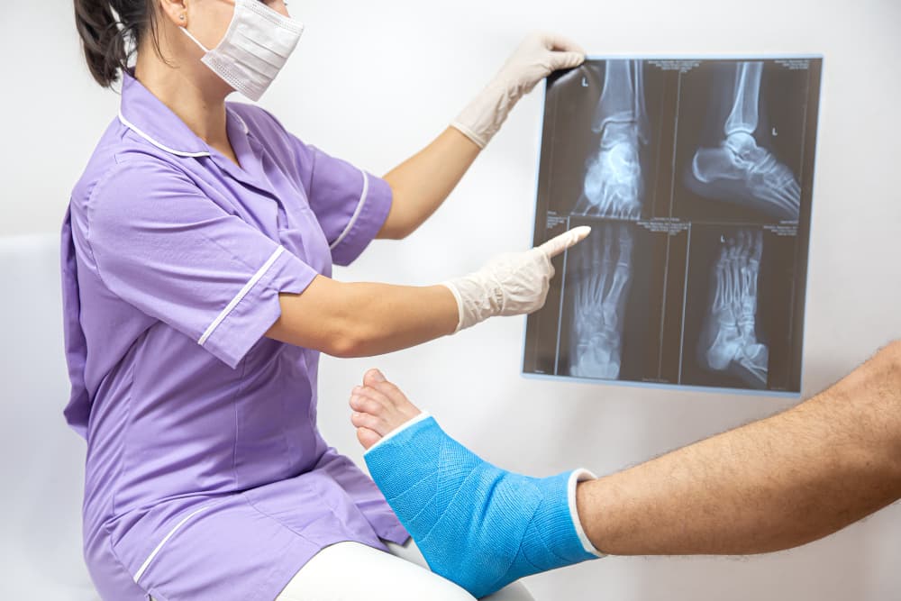 Arthrodesis (Joint Fusion) Surgery: Recovery & Types