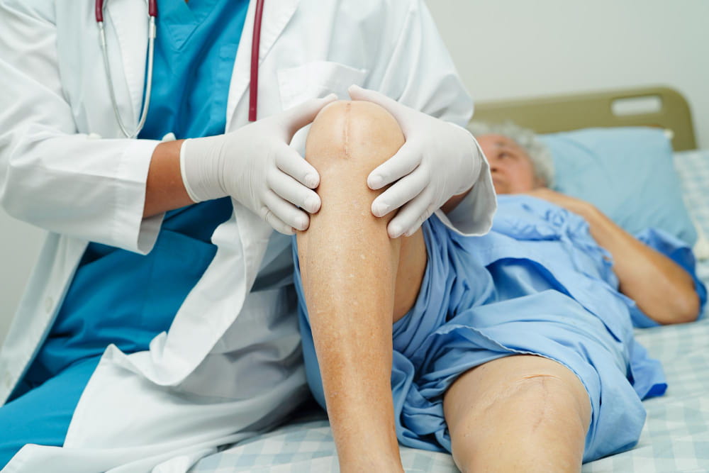 Arthroplasty: Types of Joint Replacement and Recovery