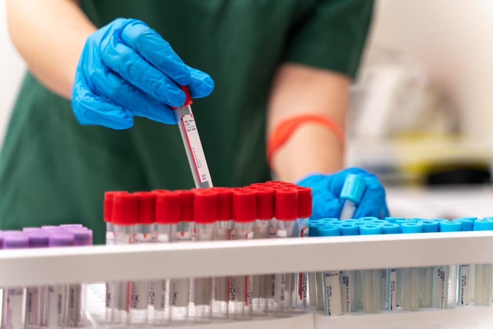 ASO Nedir? ASO Neden Yükselir?