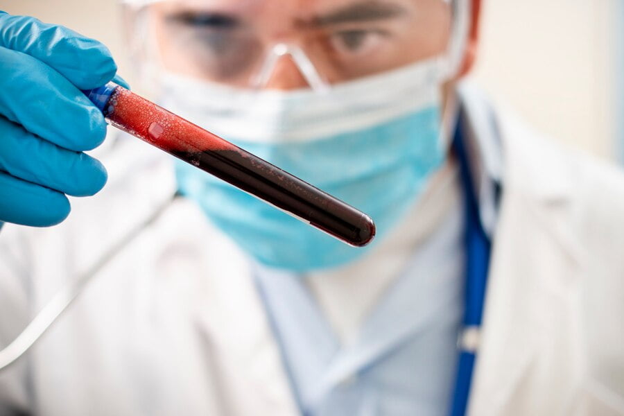 Bun Kan Tahlili Nedir? Ig Düşüklüğü, Yüksekliği!