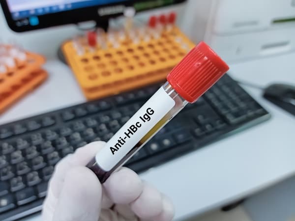 Anti HBs Nedir? Anti HBs Pozitif Ne Demek?