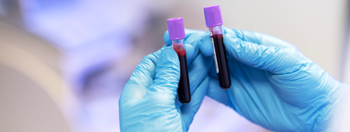 LH (Luteinizan Hormon) Nedir? LH Kaç Olmalı?