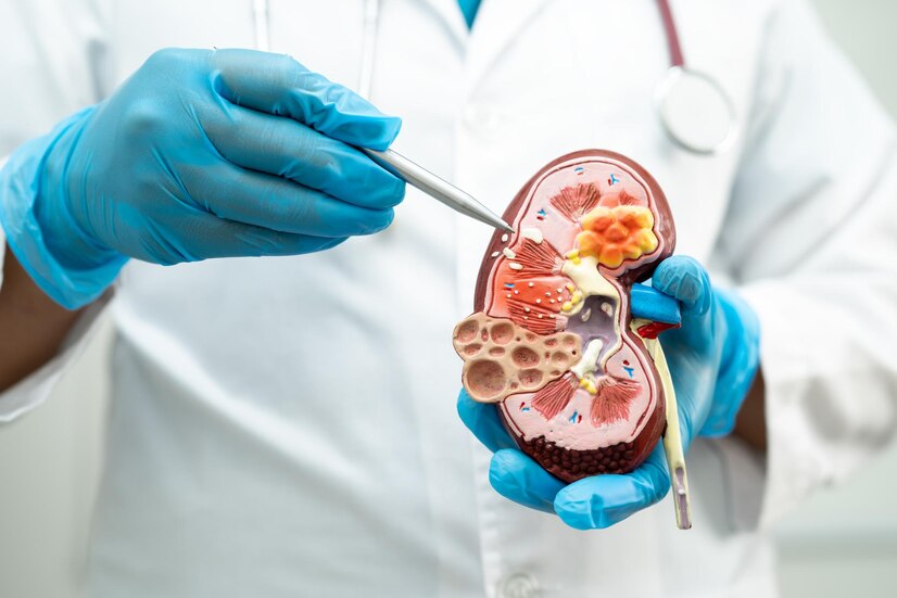 Nephrology - Medical Park