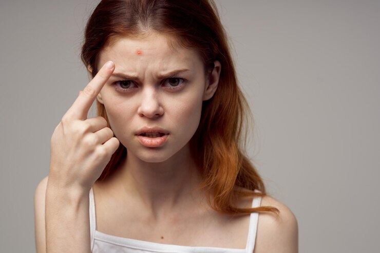 Pemfigus Vulgaris Nedir? Pemfigus Vulgaris Belirtileri ve Te