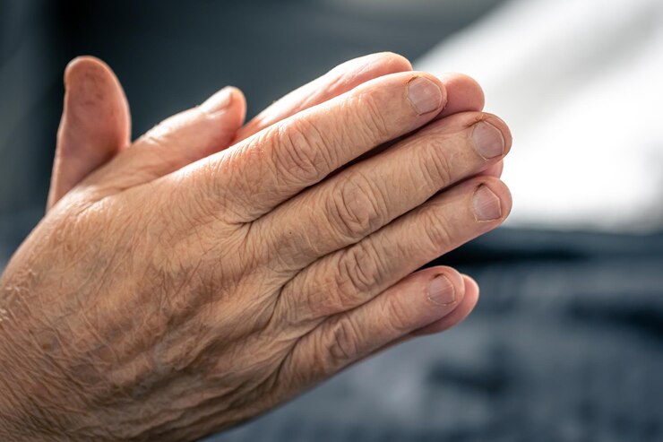 Progeria Nedir? Erken Yaşlanma Hastalığı Belirtileri ve Tedavisi