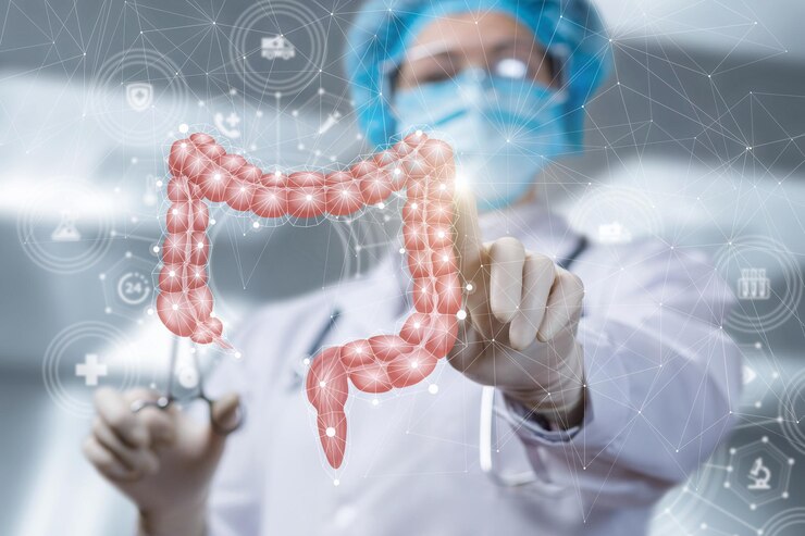 Rektum Sigmoid Kolon Duvarında Minimal Kalınlaşma Tedavisi