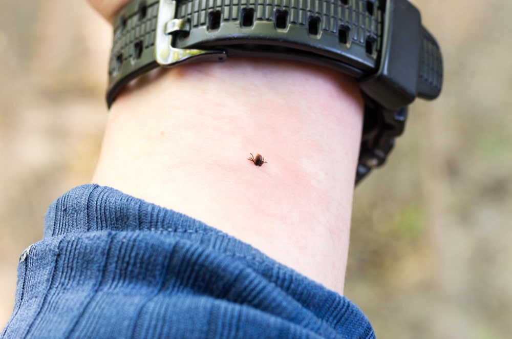 Tick Bites: Symptoms, Risks, Removal, and Prevention Guide