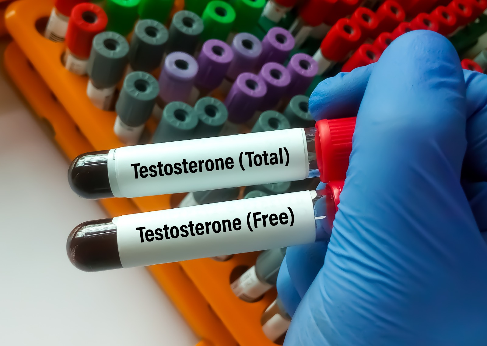 Total Testosteron Nedir?