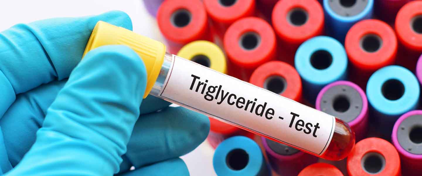 Trigliserid Nedir? Trigliserid Yüksekliği Ne Anlama Gelir?