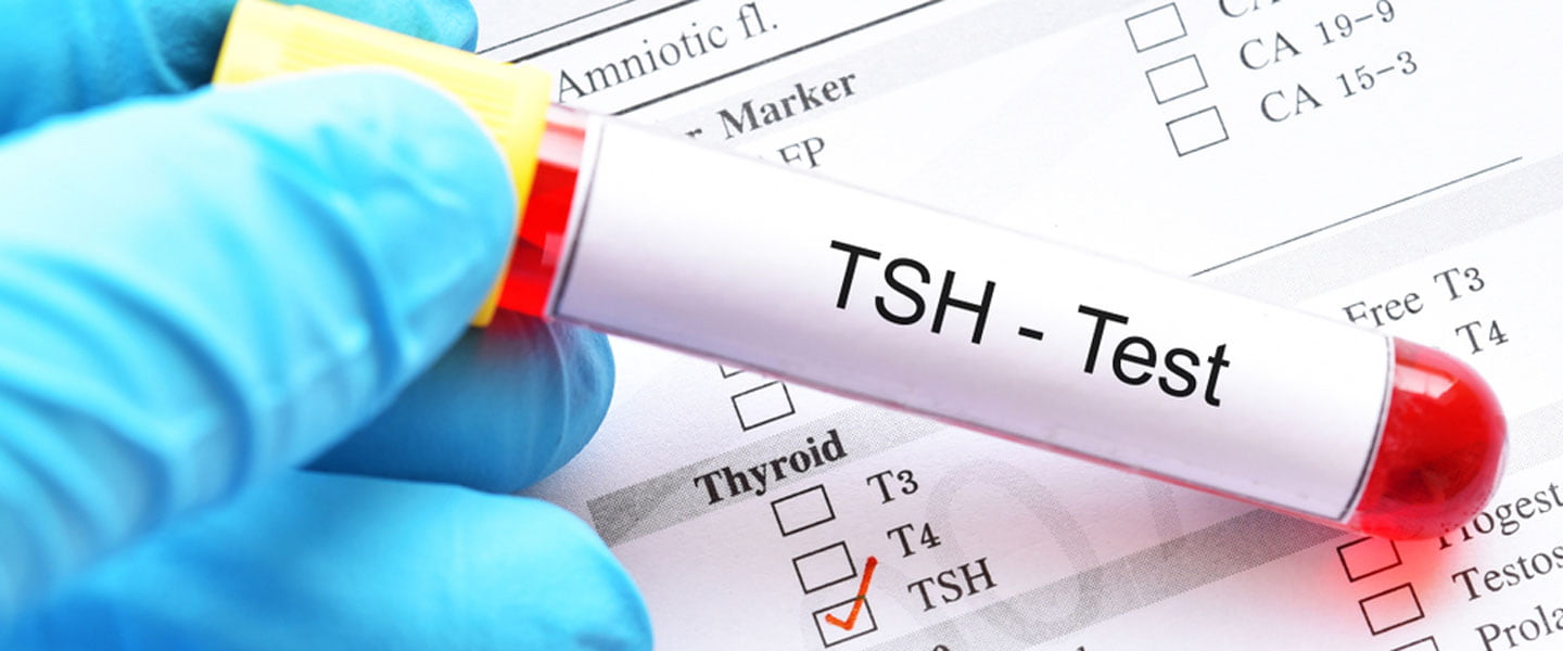 TSH Nedir? Yüksek Tiroidin Zararları Nelerdir?